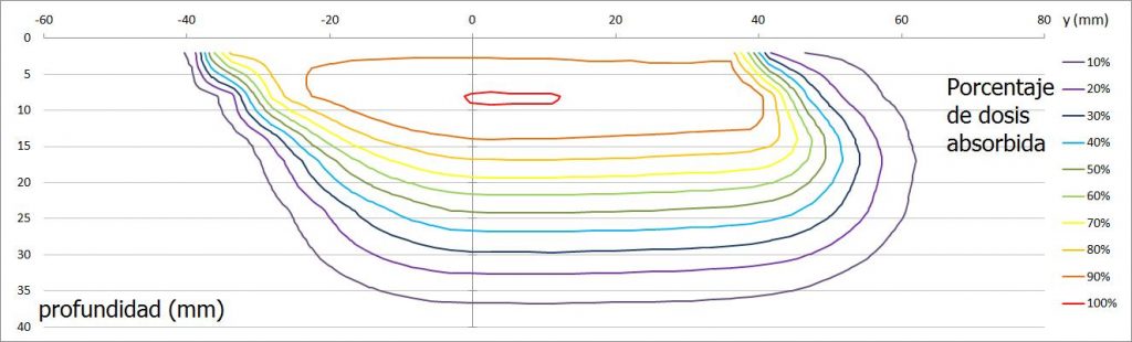 ¿Qué es la radioterapia intraoperatoria? (parte III de III) - Física médica